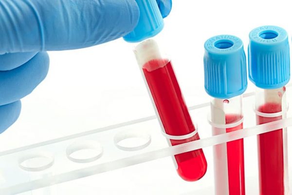 Análisis Clínicos - Hospital de Día PyC