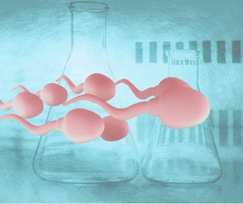 Seminograma / Espermiograma - Hospital de Día PyC