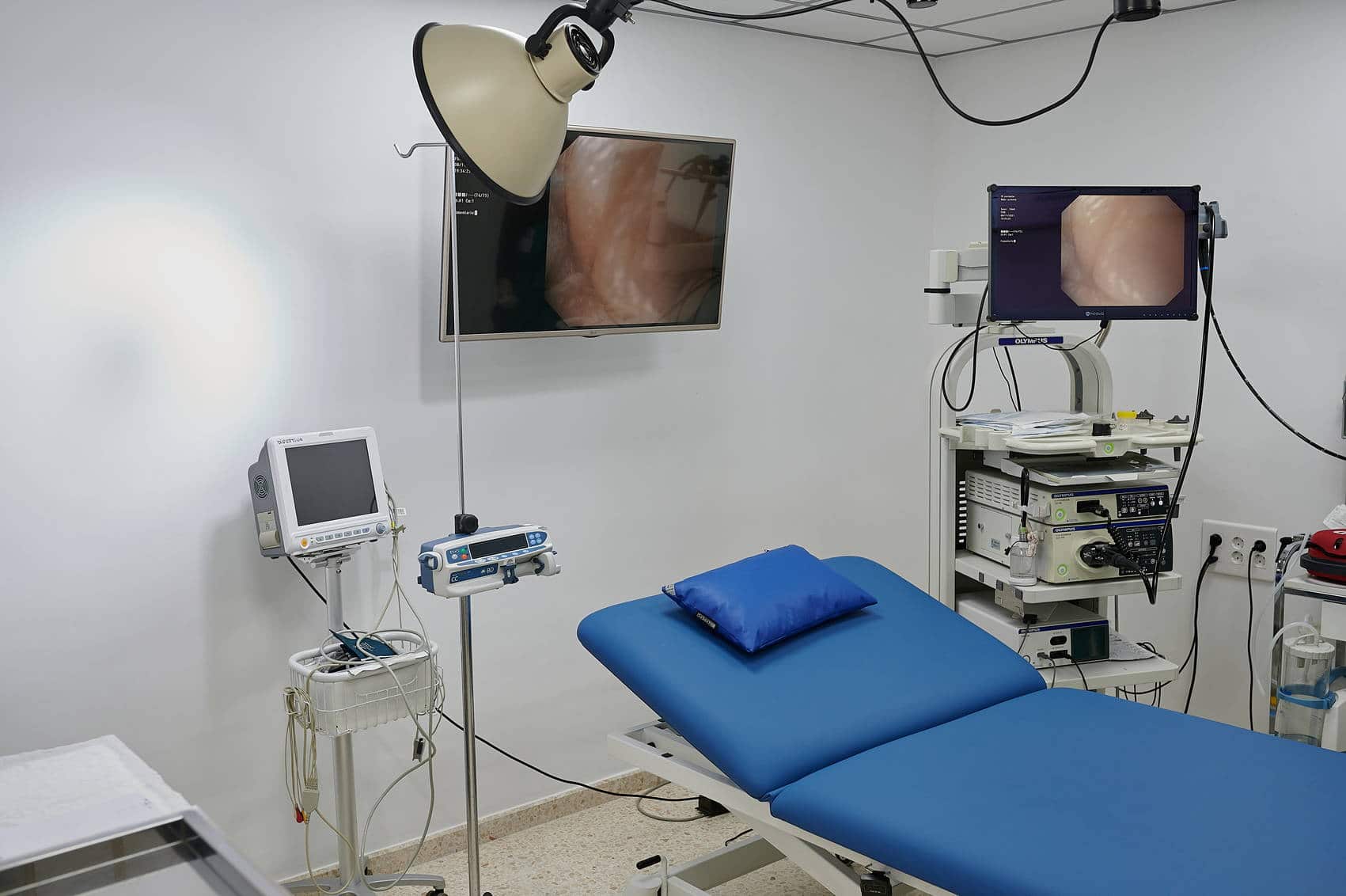 Sala de Endoscopias y Colonoscopias - Hospital de Día PyC